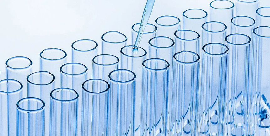 What is a fully automatic biochemical analyzer and the principle of a ...