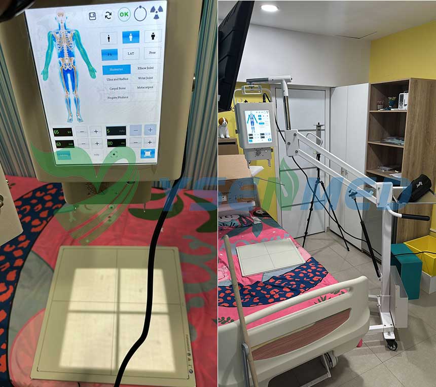YSX056-PE portable digital x-ray system set up in a clinic in Venezuela